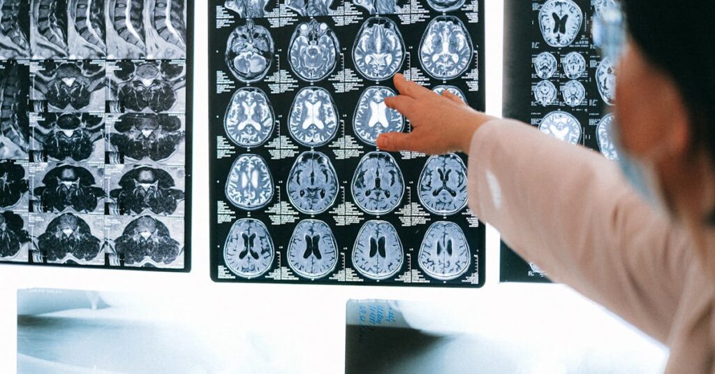 What to Expect on the Certified Neuroscience Registered Nurse Exam ...